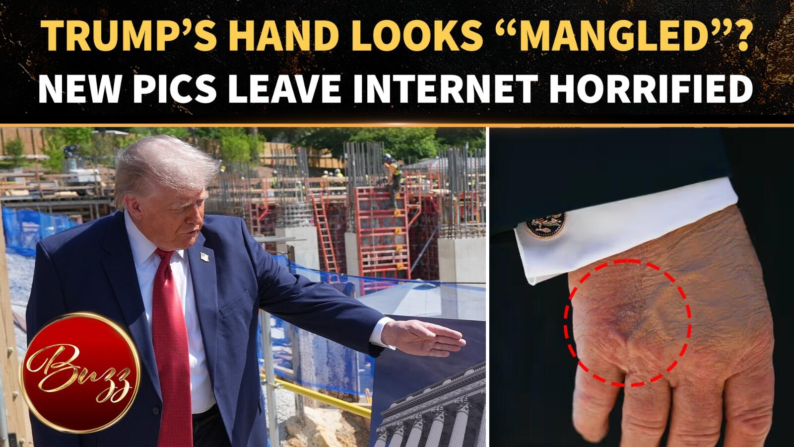 Trump’s ‘Rotting in real time’ photos spark wild internet meltdown ...