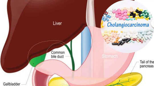 Influencer Sydney Towle shares devastating spread of rare bile duct ...