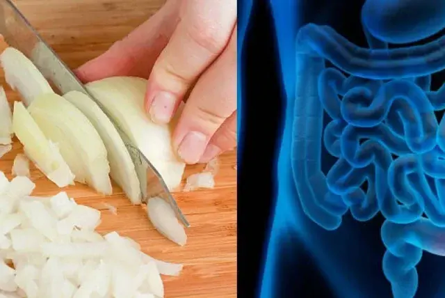 Compuesto de la cebolla podría ayudar a combatir el cáncer de colon ...