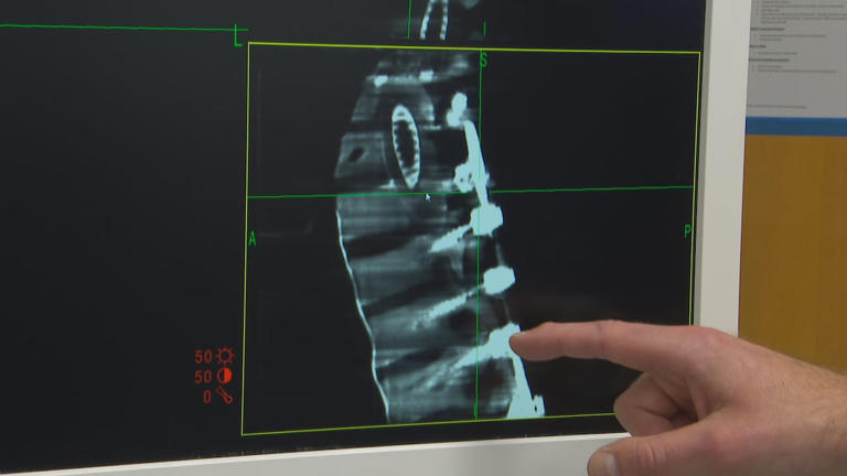Moncton teen becomes first IWK patient to receive improved imaging ...