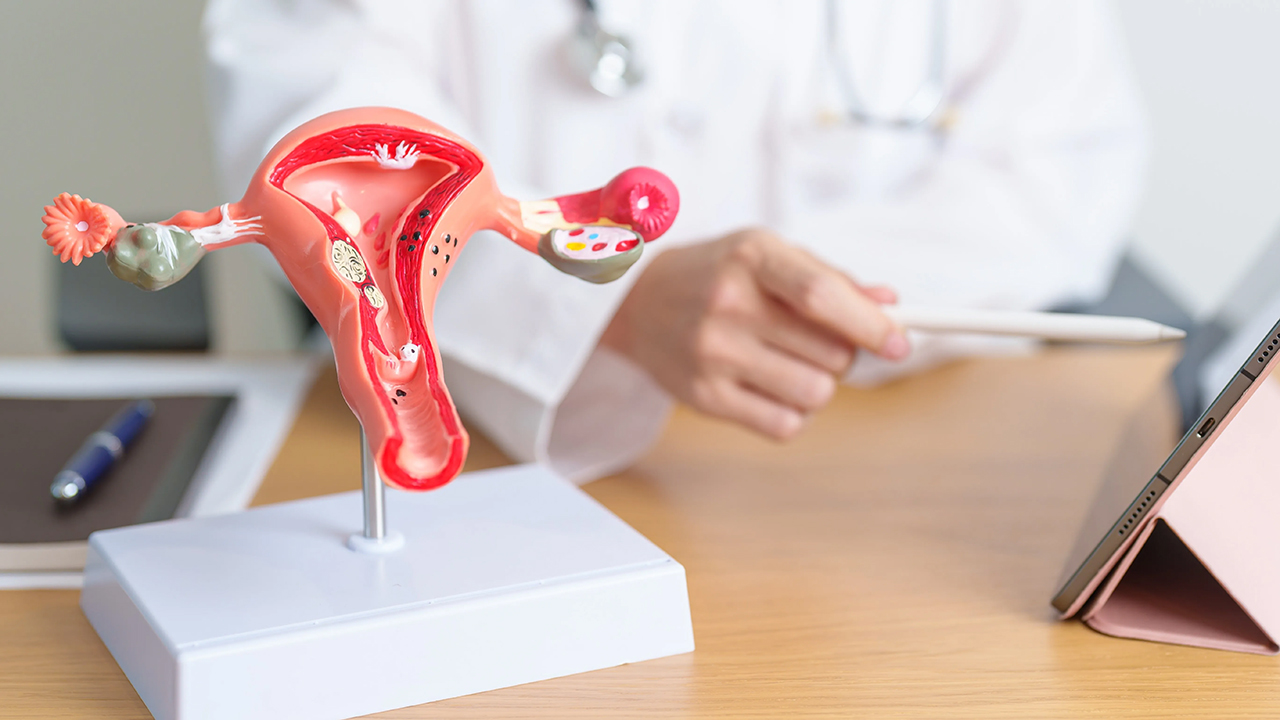 PCOS is now called PMOS - here's what the name change really means