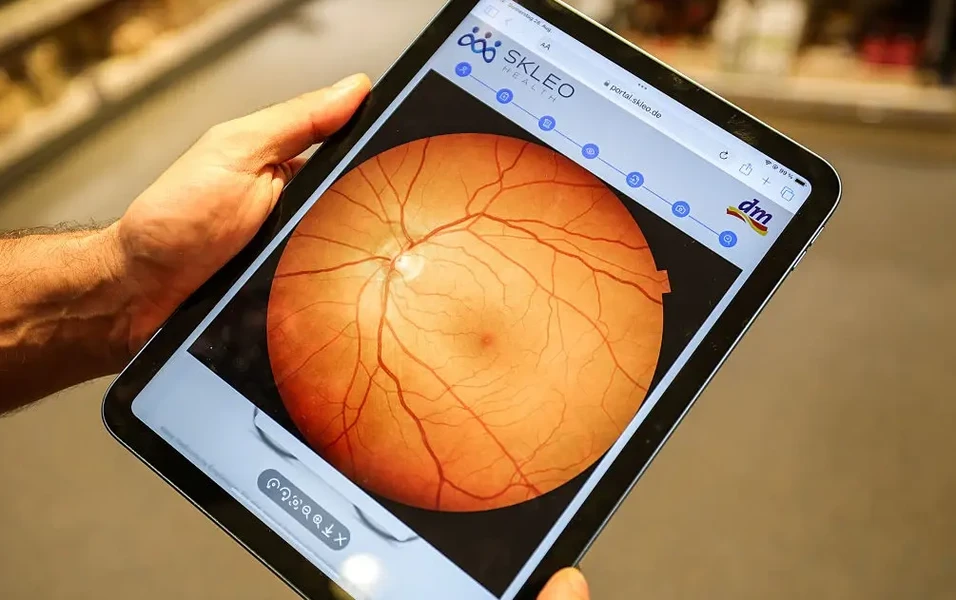 Protect your sight from diabetic retinopathy risks