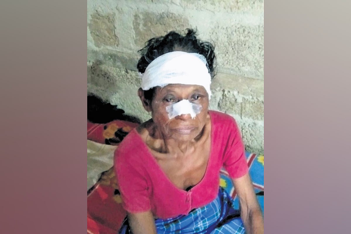 74-year-old left critically injured by aggressive rooster in Kollam