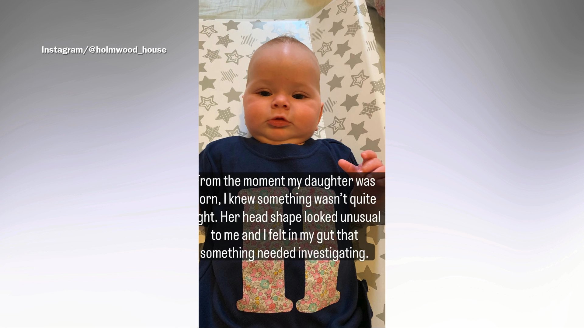 Doctors dismissed my newborn’s head shape—then came terrifying diagnosis