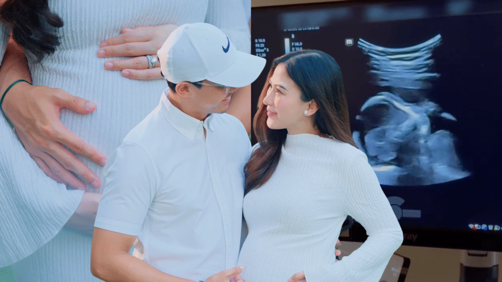Alex Gonzaga, Mikee Morada announce pregnancy