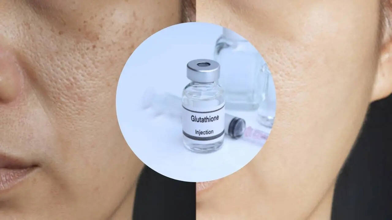 Beauty injection crackdown: Government warns glutathione drips and anti ...