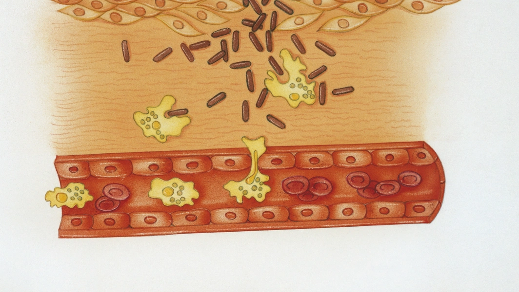 Eating your way to calmer inflammation