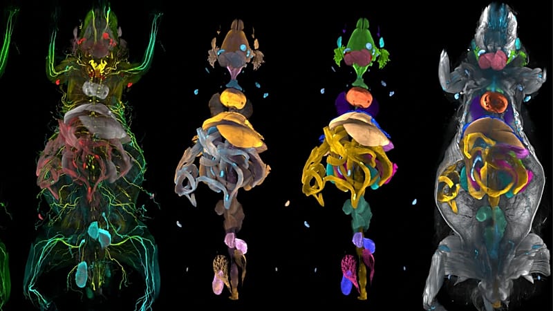 Nuevo atlas de IA revela cómo la obesidad afecta a todo el cuerpo