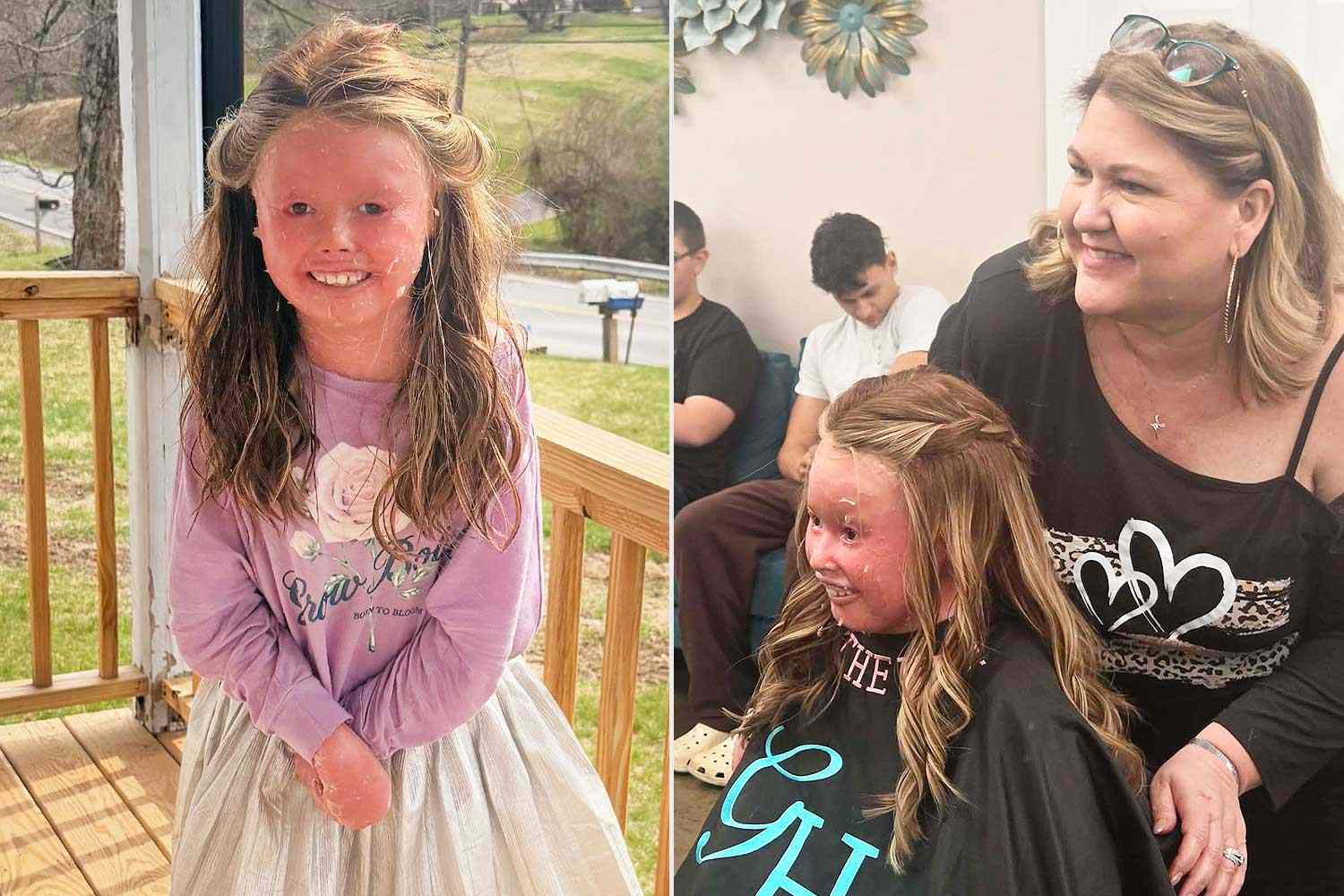 Born with a rare skin condition, 8-year-old girl's mood changes in 'one ...