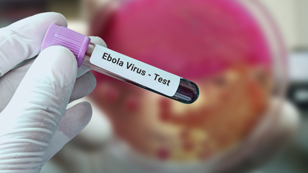 US orders Ebola screening at Dulles Airport for travelers from Congo ...