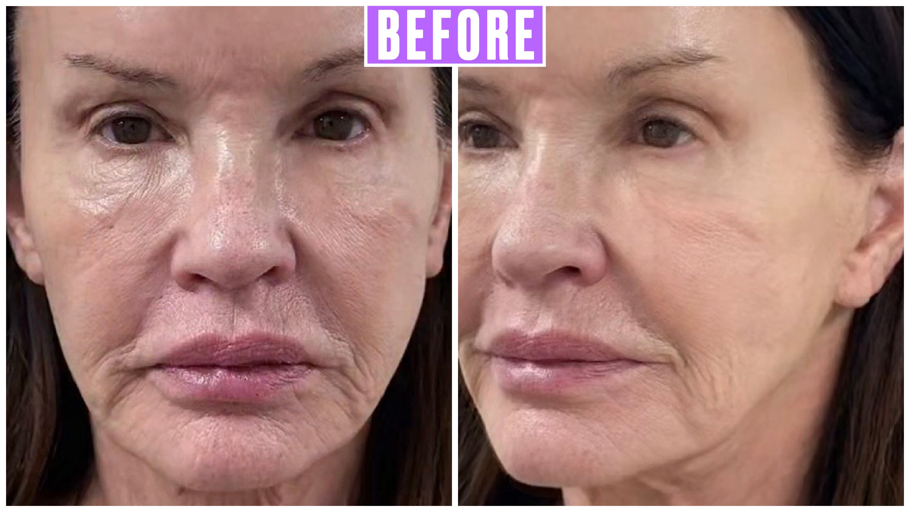 America’s Next Top Model star reveals jaw-dropping facelift