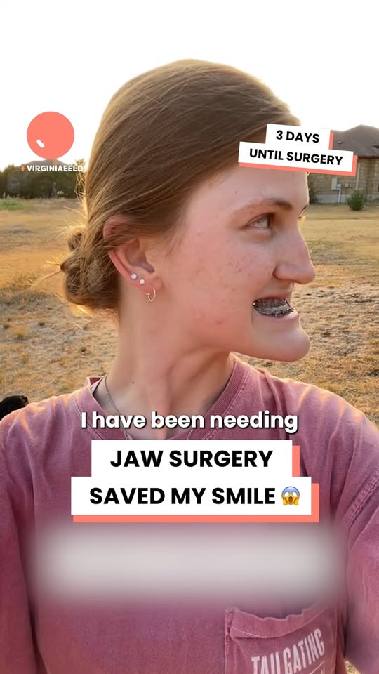 Jaw surgery saved my smile