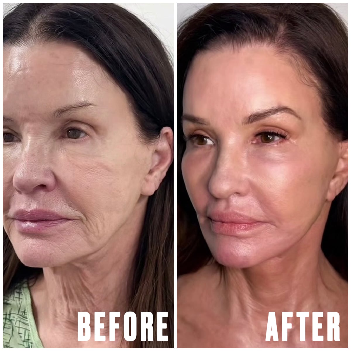America’s Next Top Model star reveals jaw-dropping facelift