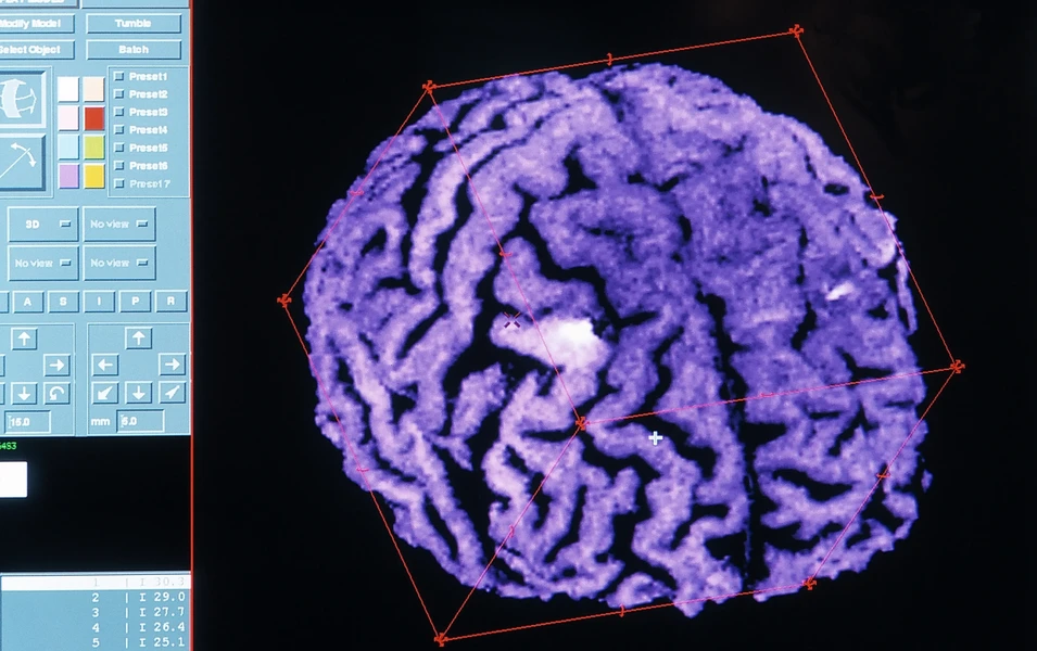 Brain scans reveal shift in math processing with expertise