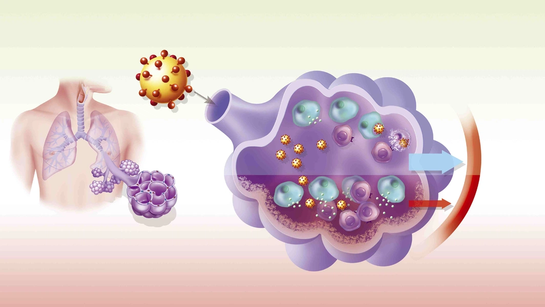 Studies link chronic inflammation to hidden and overlapping illnesses