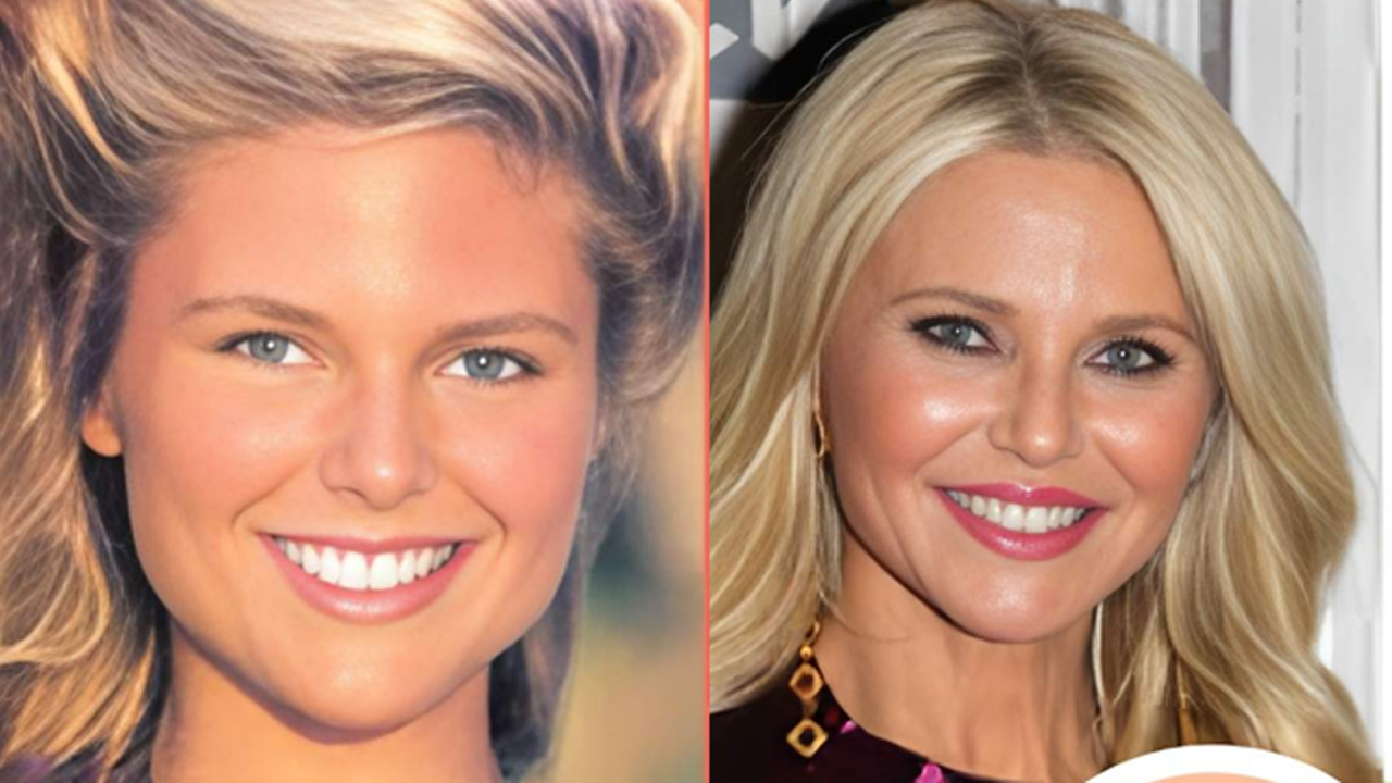 Doctor reacts to Christie Brinkley’s plastic surgery