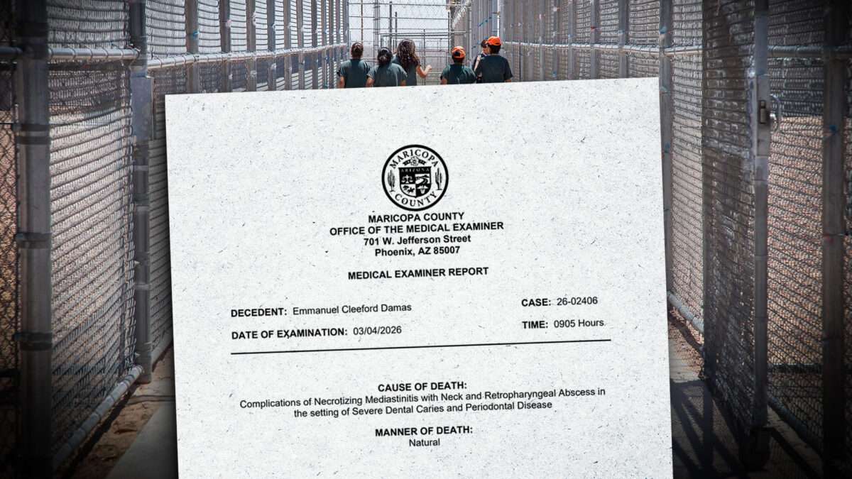 An ICE detainee died from a tooth infection, autopsy report says