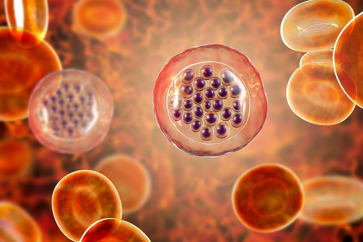 Delayed diagnosis seen in more than one in four pediatric patients with ...