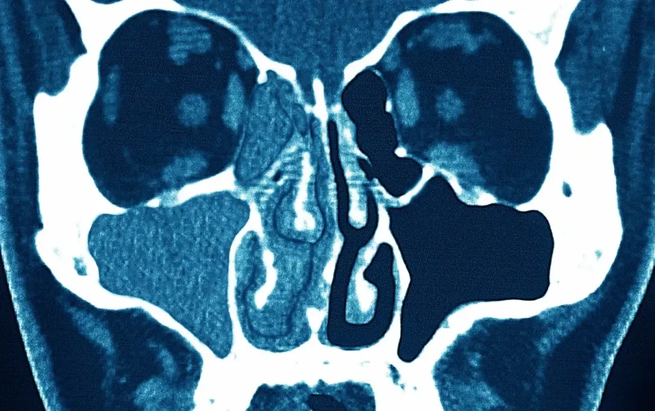Studies link chronic inflammation to hidden and overlapping illnesses