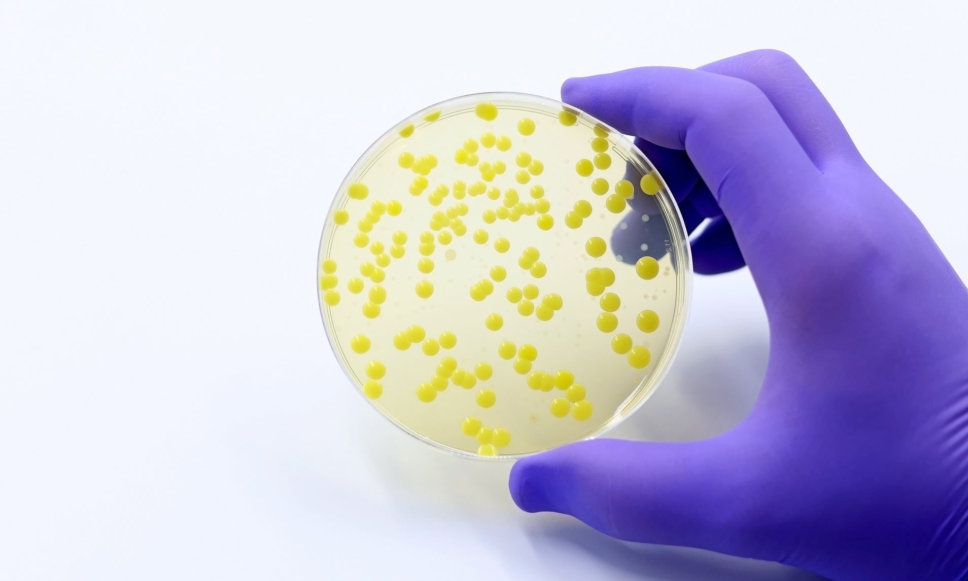Mystery bacterial outbreak sickens more than a dozen as officials race ...