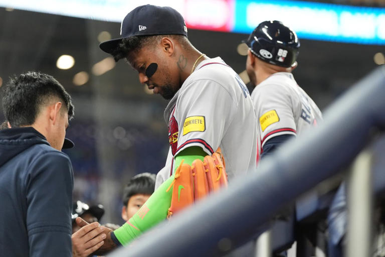 Ronald Acuna Jr. exits game with thumb issue in latest Braves concern