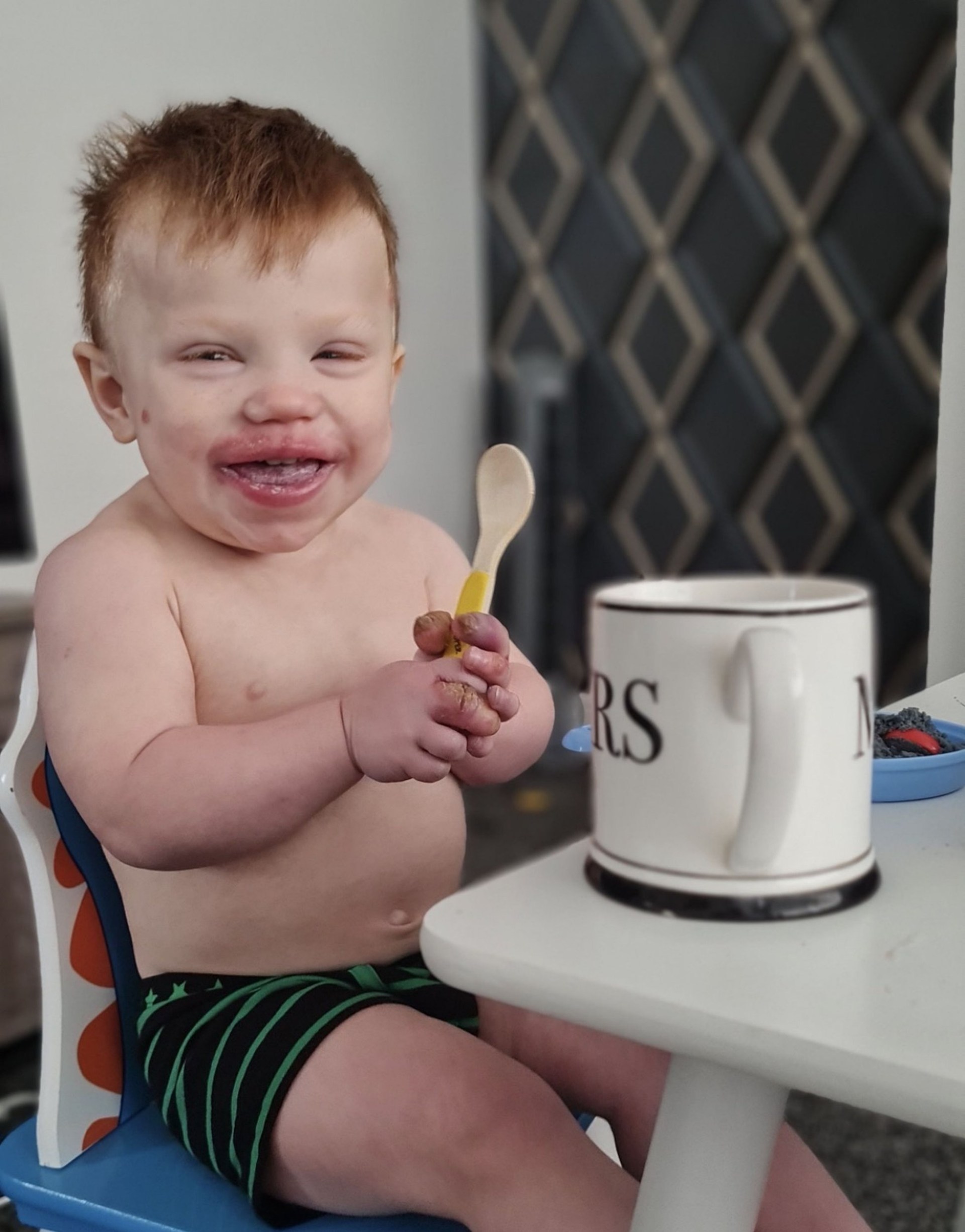 I’ve had thrush for 30 years — now my son has it too