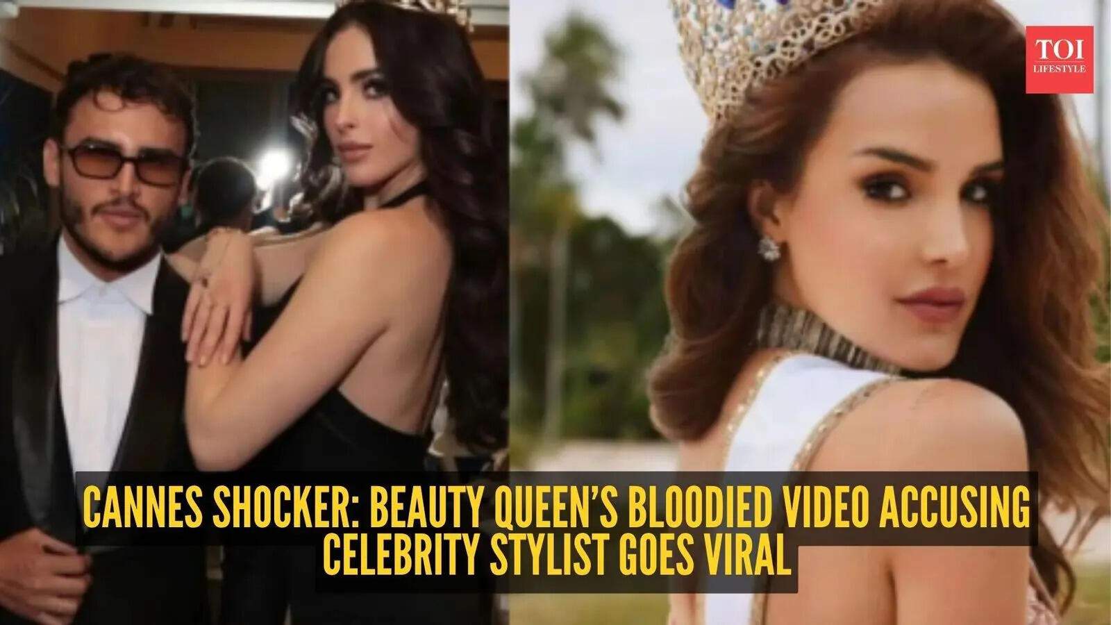 Venezuelan model, beauty queen Andrea del Val accuses celebrity stylist ...