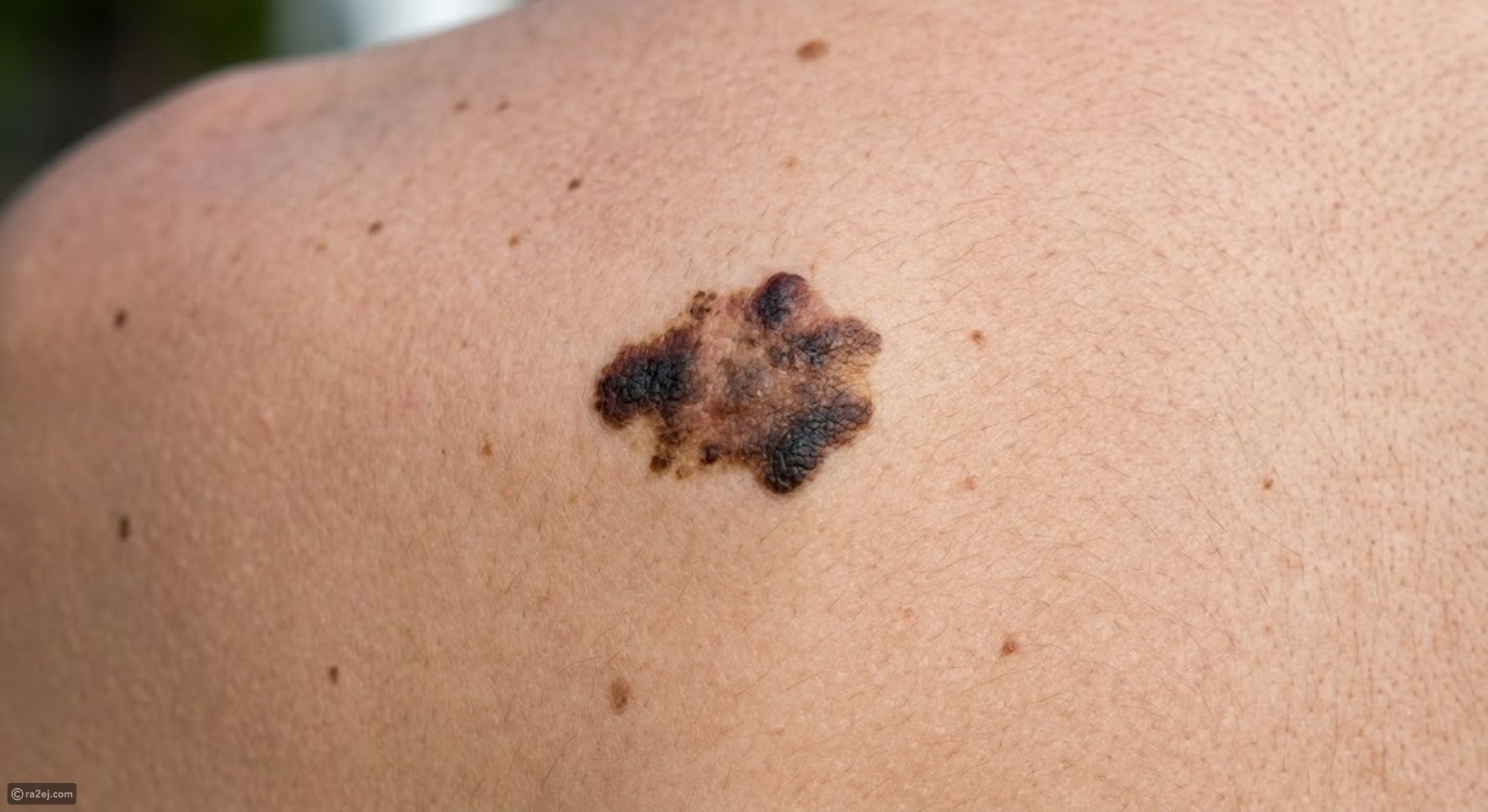 10 body spots that could reveal if something is wrong with your health