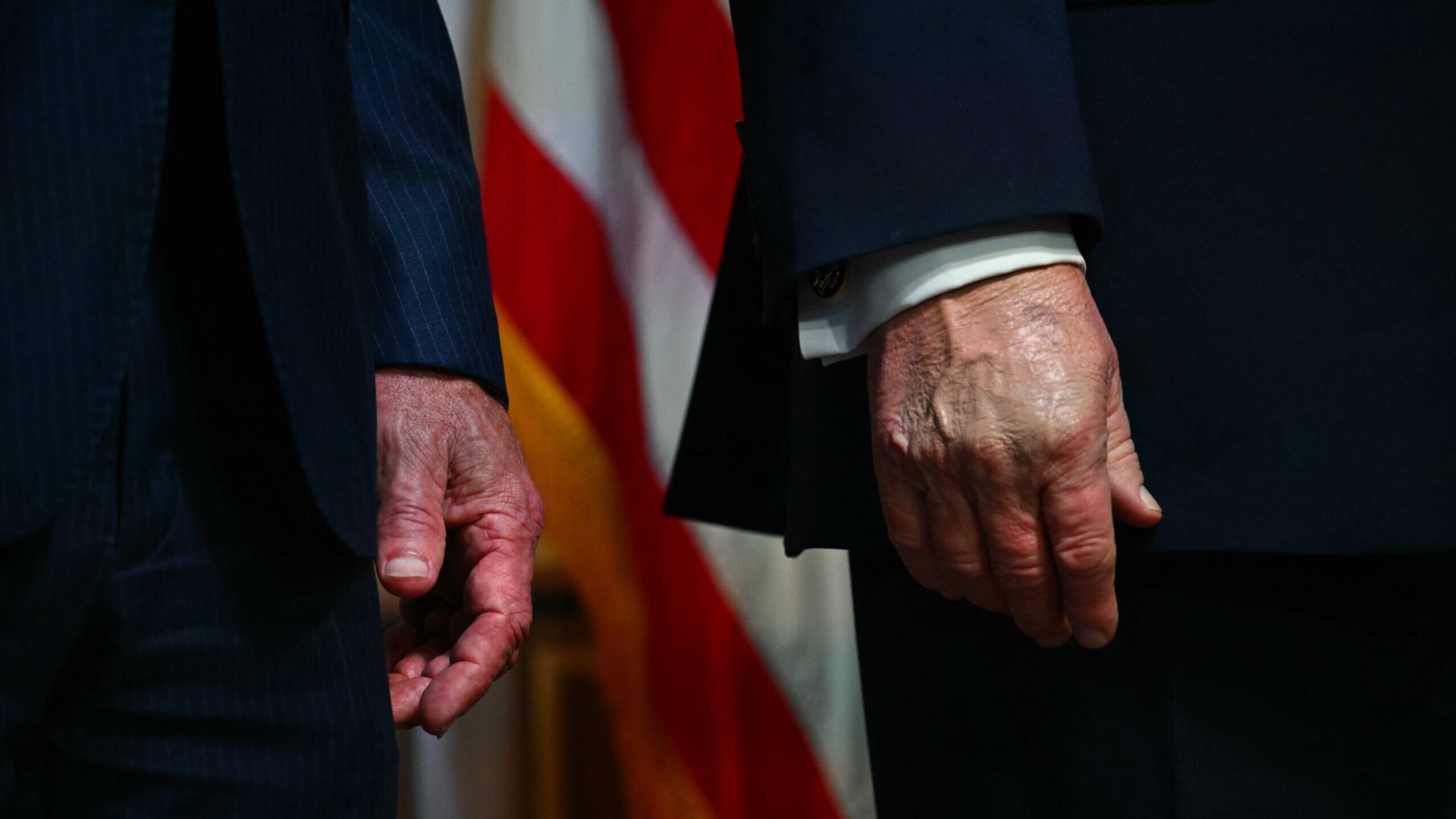 RFK Jr.’s Hand Looks A Lot Like Trump’s Now & People Are Concerned