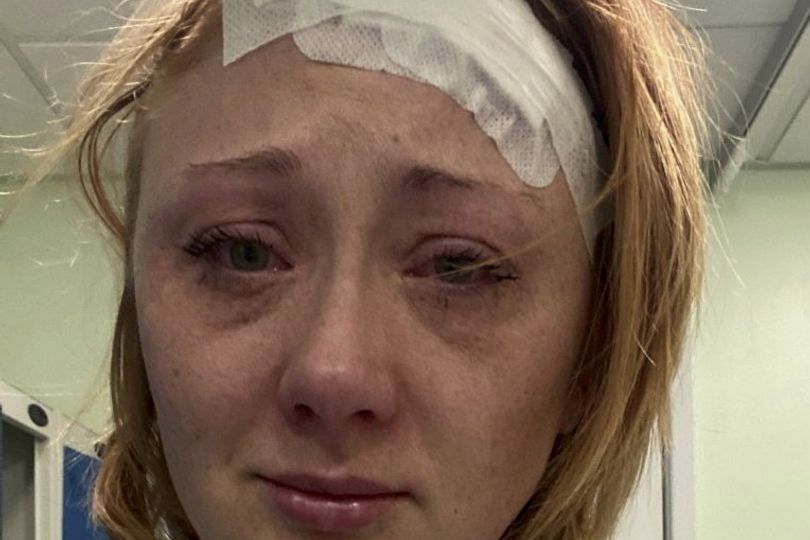 Sunbed Stacey, 39, has this skin cancer warning for you