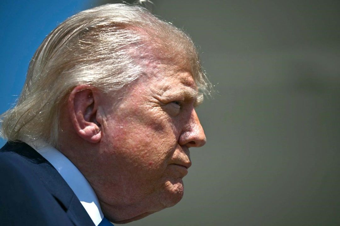 Donald Trump's thinning hairline and 'rat tails' go viral as health ...