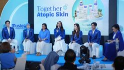 Reisa Broto Asmoro dampingi anak merawat kulit atopik: Saya tenang ...