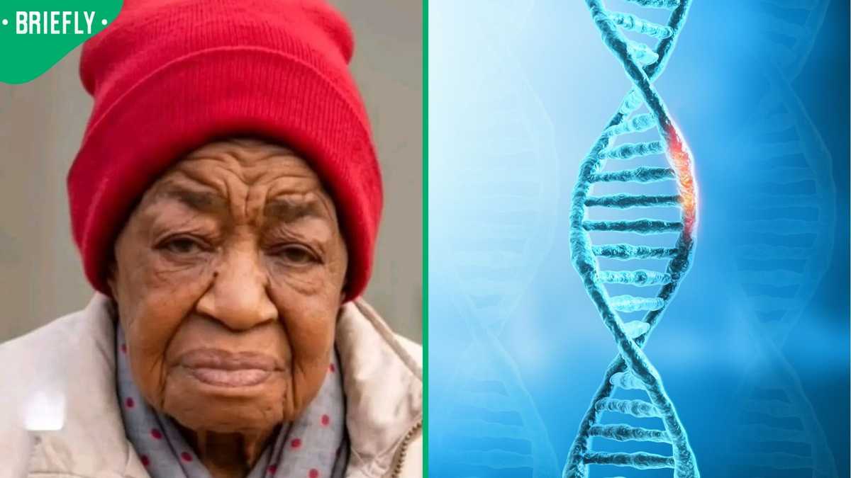 Werner syndrome: Explaining the rare genetic disorder behind South ...