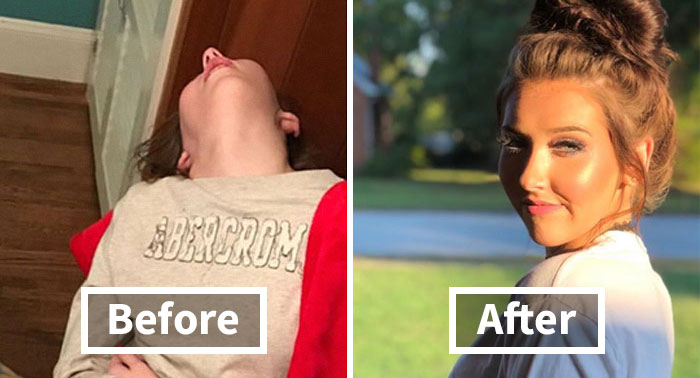 The Addict’s Diary showcases before & after transformations of people ...