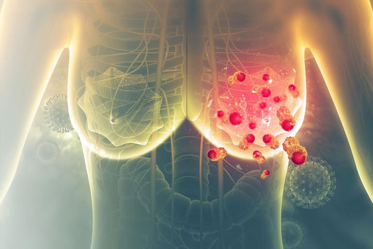 FDA approves Enhertu as neoadjuvant, adjuvant treatment for breast cancer