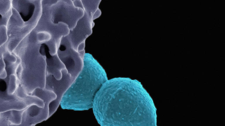 Scientists just found that a single amino acid from protein-rich food ...