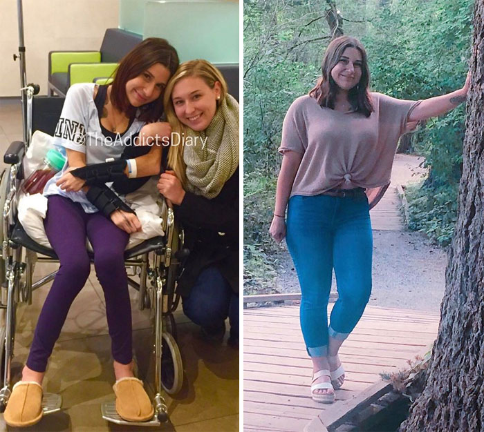 The Addict’s Diary showcases before & after transformations of people ...