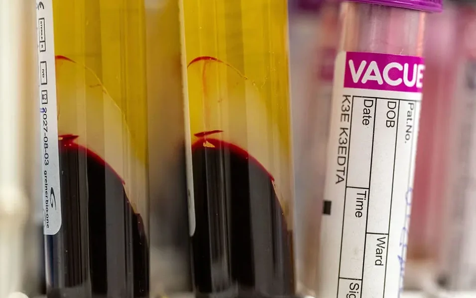 Your blood tells your health story