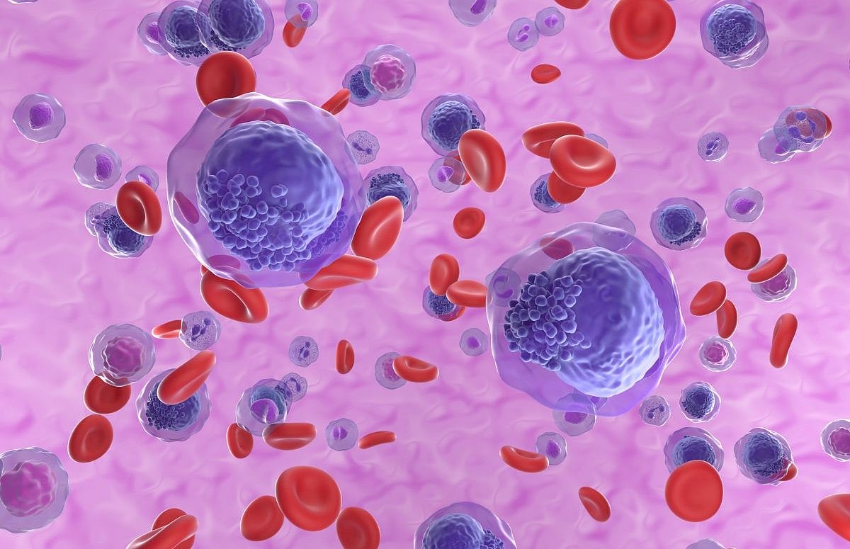 FDA approves Inqovi for acute myeloid leukemia