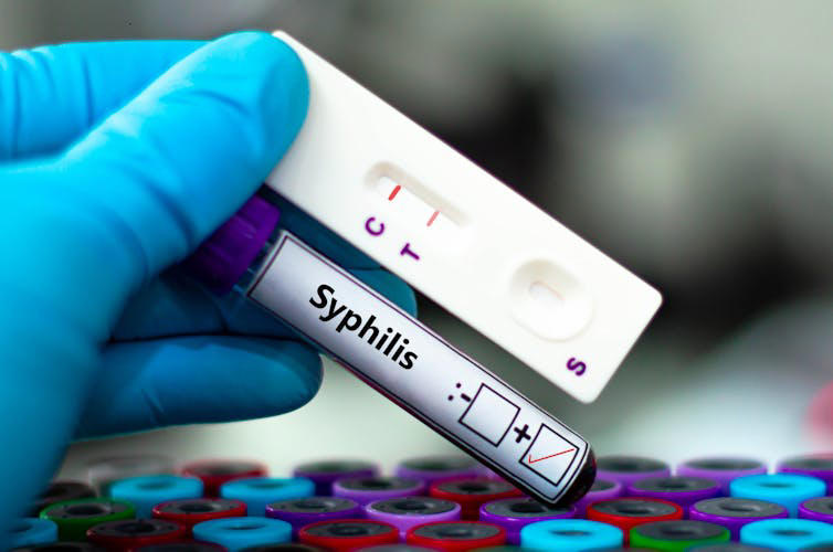 Syphilis cases in expectant mothers have dramatically risen since the ...