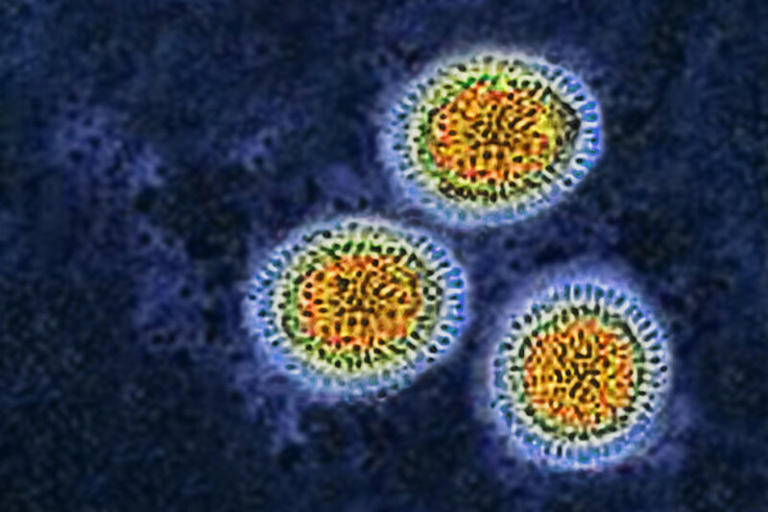 Amid outbreaks, an age-old theory is being resurrected online: viruses ...