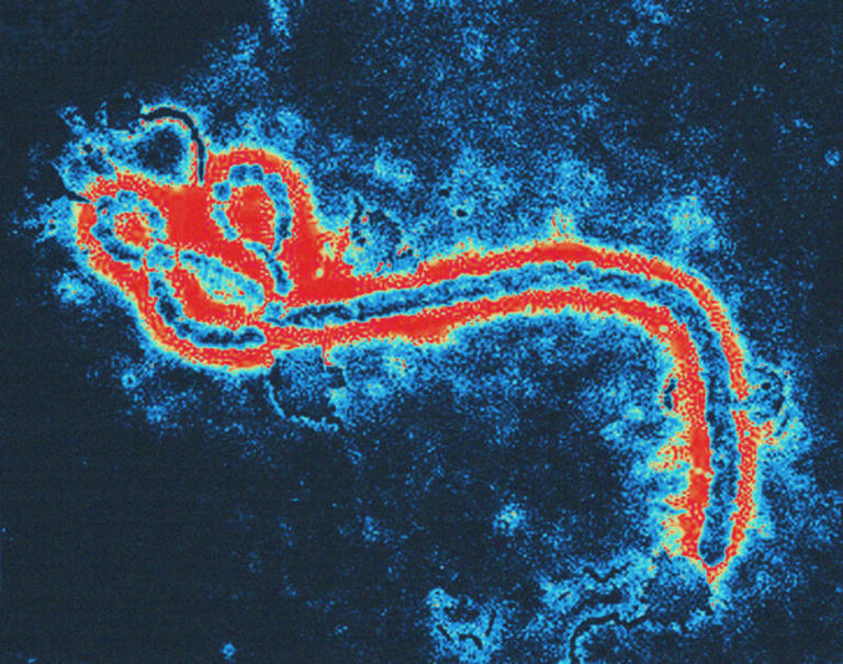Amid outbreaks, an age-old theory is being resurrected online: viruses ...