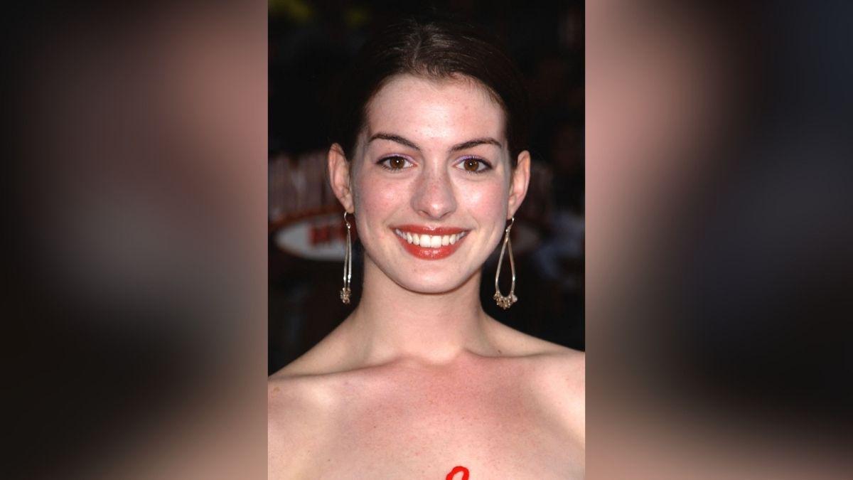 Inside Anne Hathaway's transformation as plastic surgery rumors swirl ...