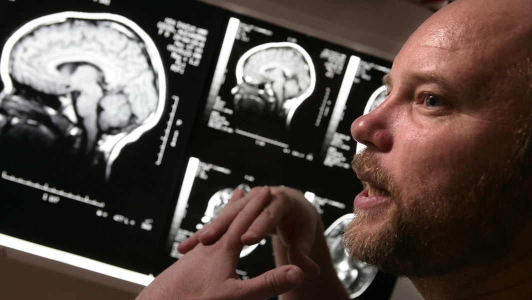 New research challenges long-held ADHD brain maturation theory