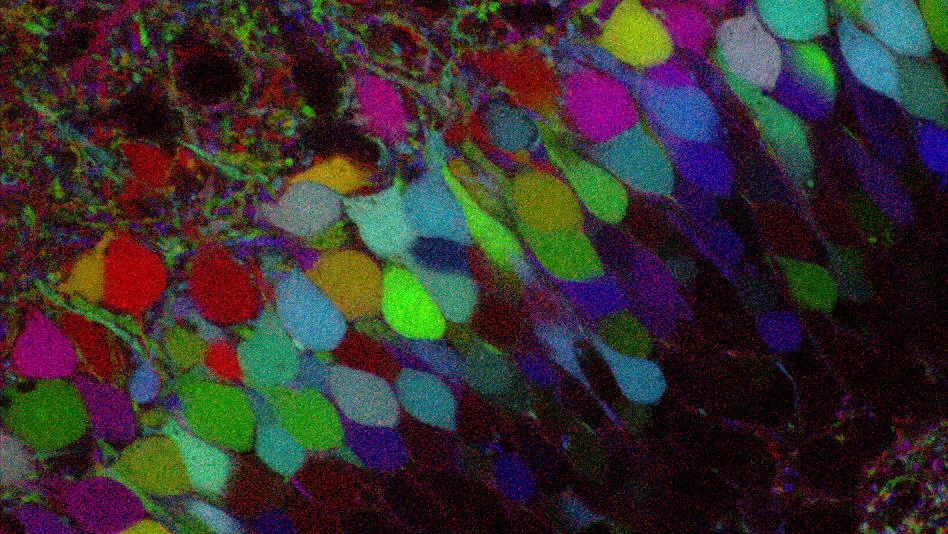 Study finds brain memory hub starts full, prunes for efficiency