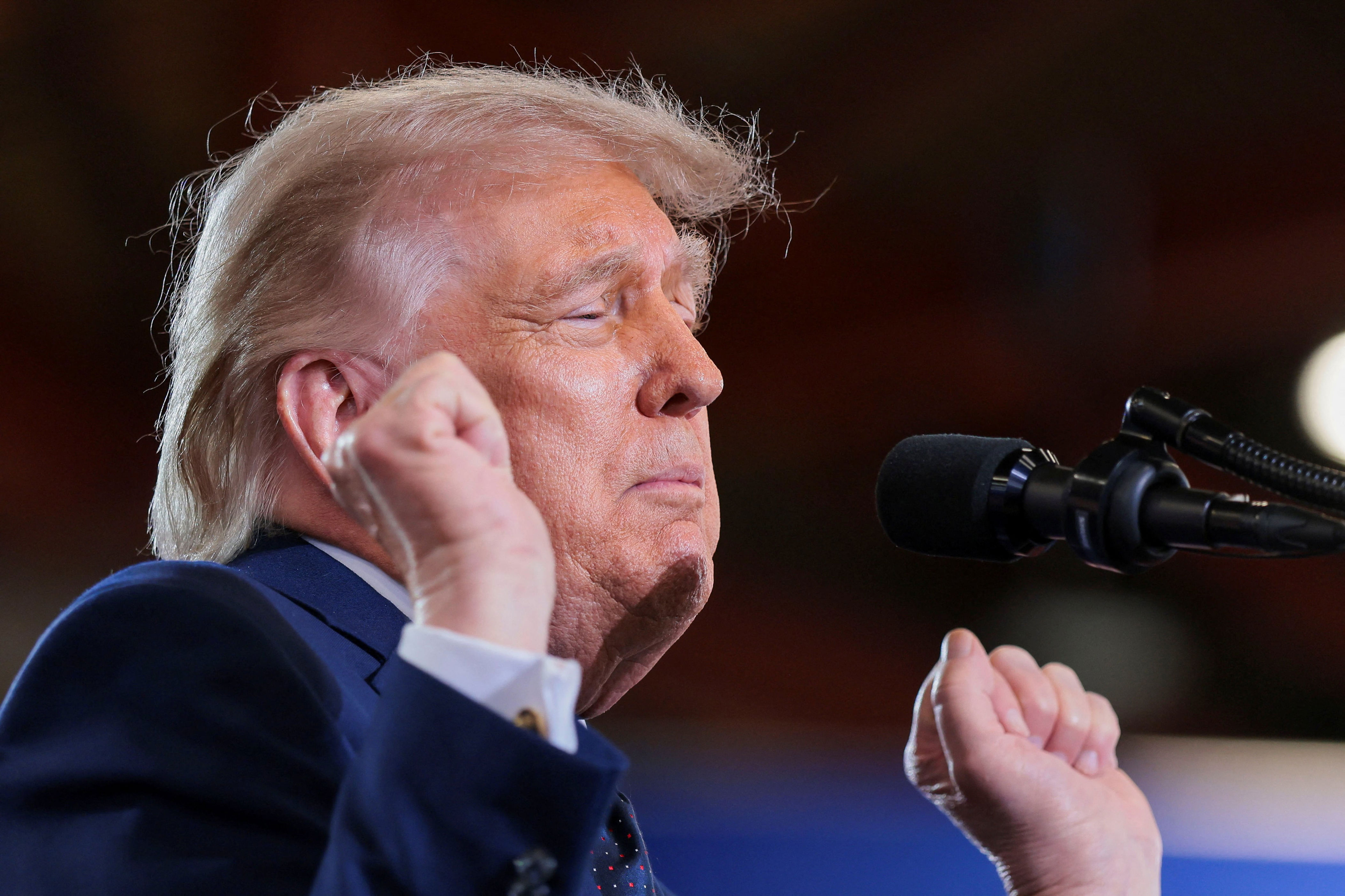 Trump, 79, flashes heavily bruised hand ahead of holiday weekend