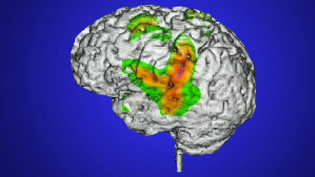 Why learning languages changes your brain and life