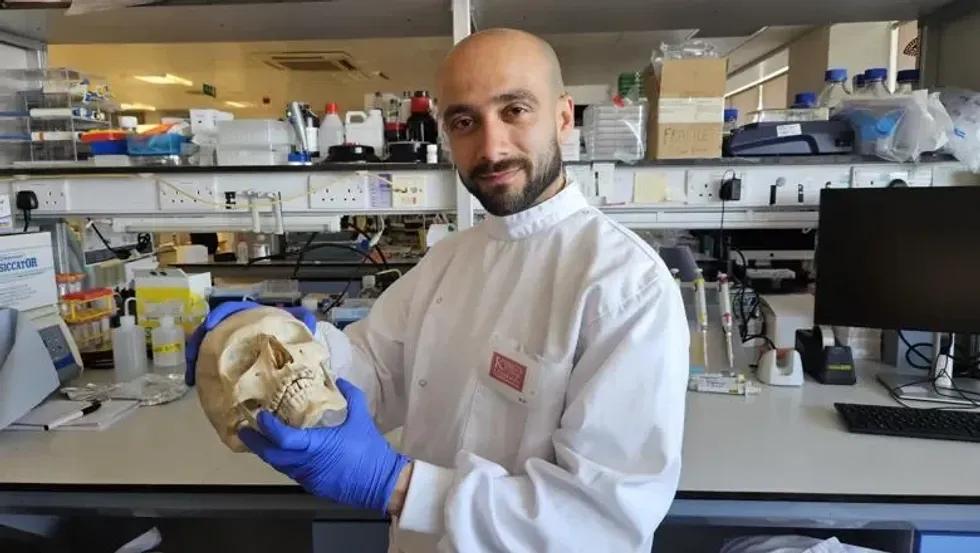 Scientists at UK university turn sheep wool into bone-healing material ...