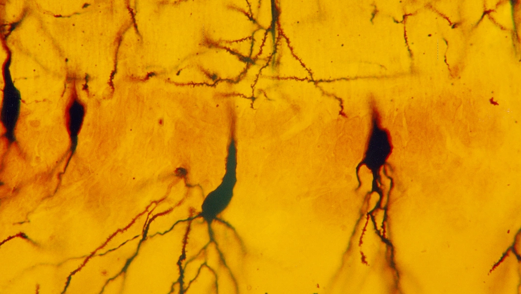 Brain's memory hub prunes excess links for lifelong efficiency
