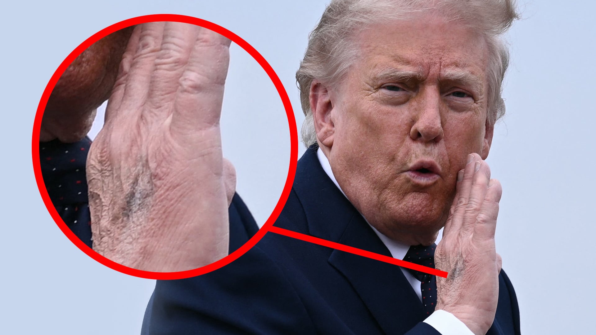Trump, 79, flashes heavily bruised hand ahead of holiday weekend